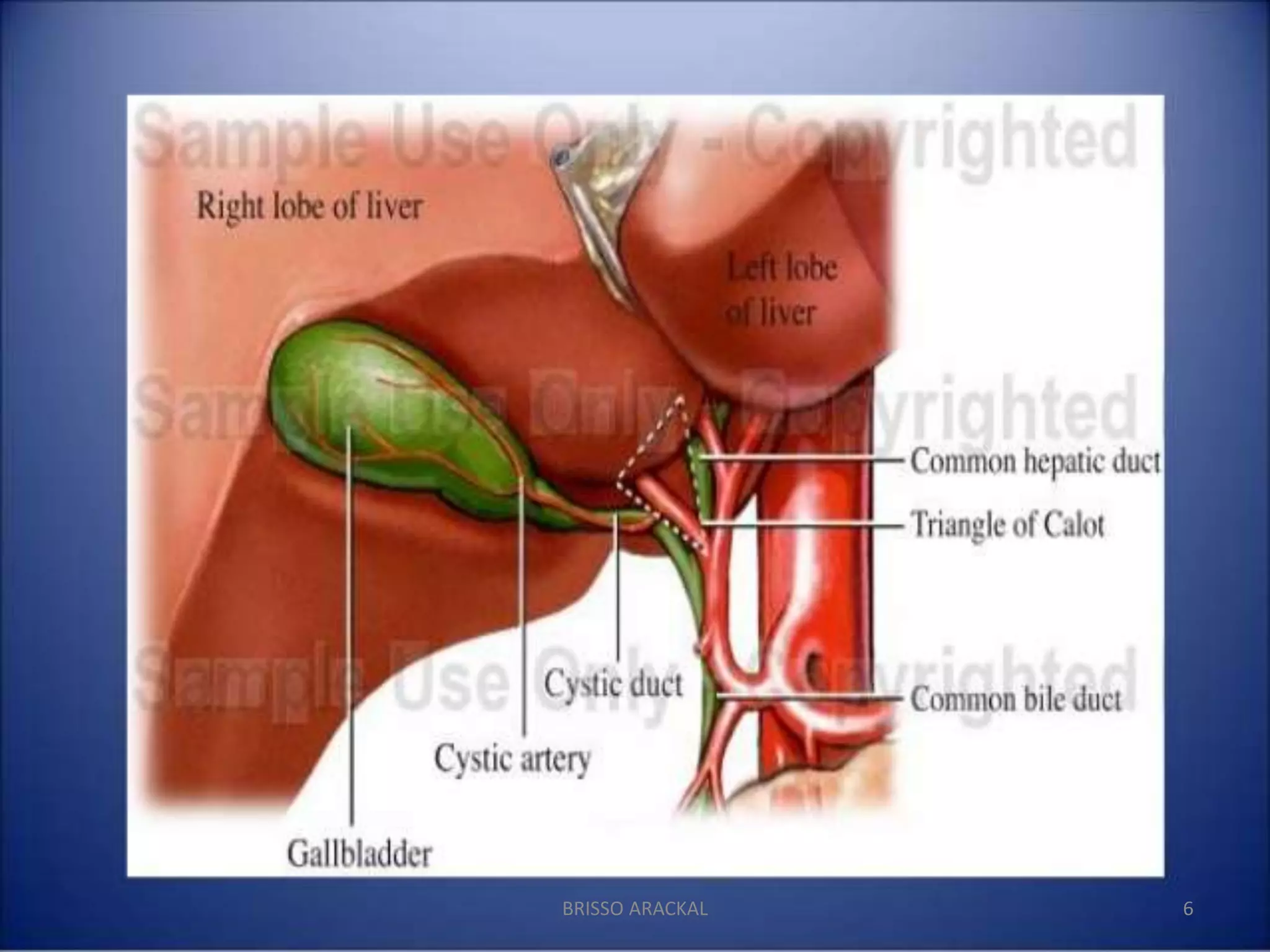 Gall bladder | PPTX