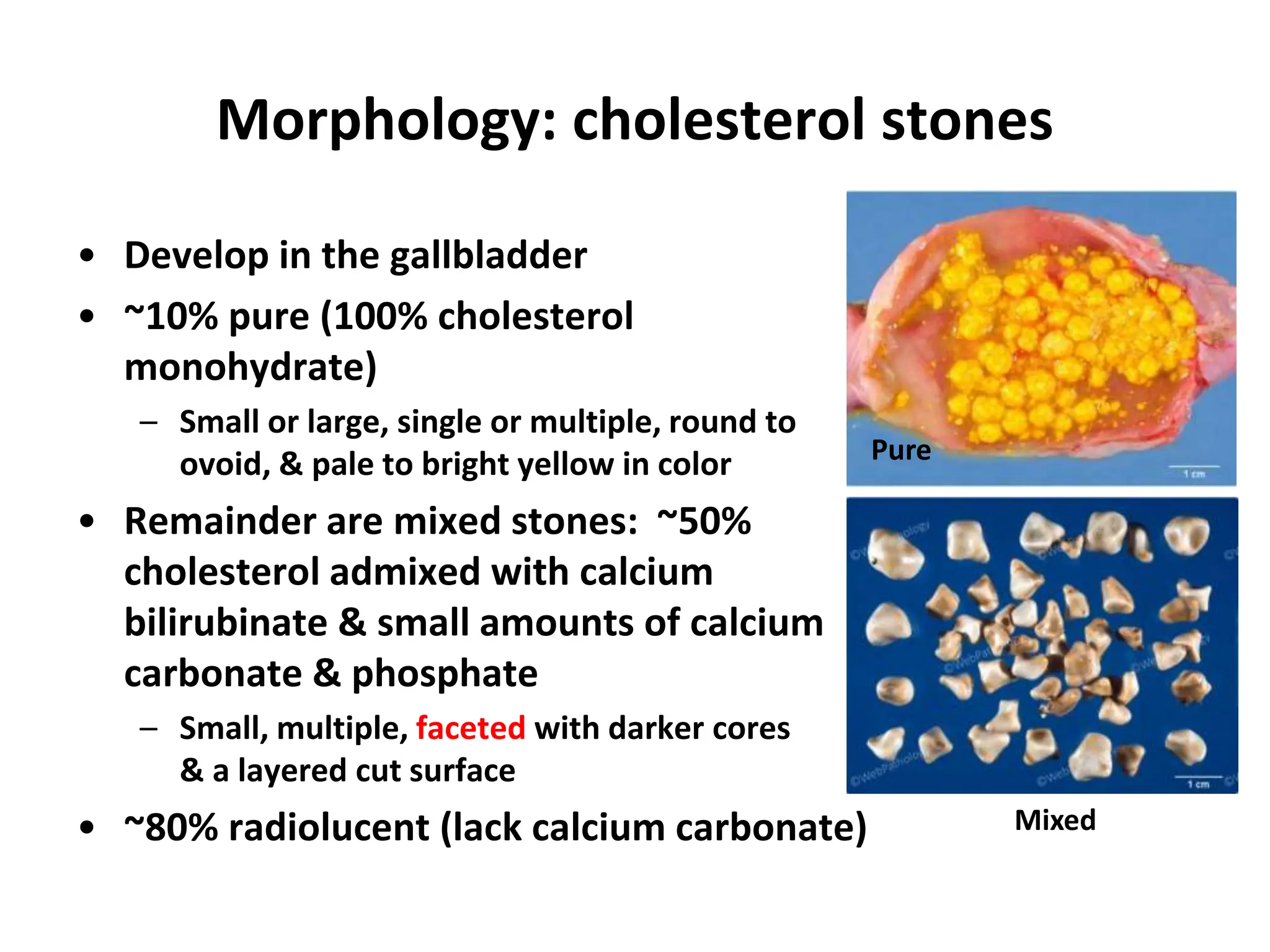 GALL BLADDER from medicine pathology course | PPT