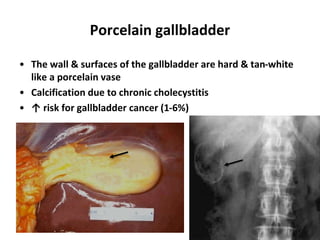 GALL BLADDER from medicine pathology course | PPT