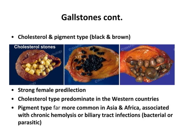 GALL BLADDER from medicine pathology course | PPT | Digestive Disorders ...