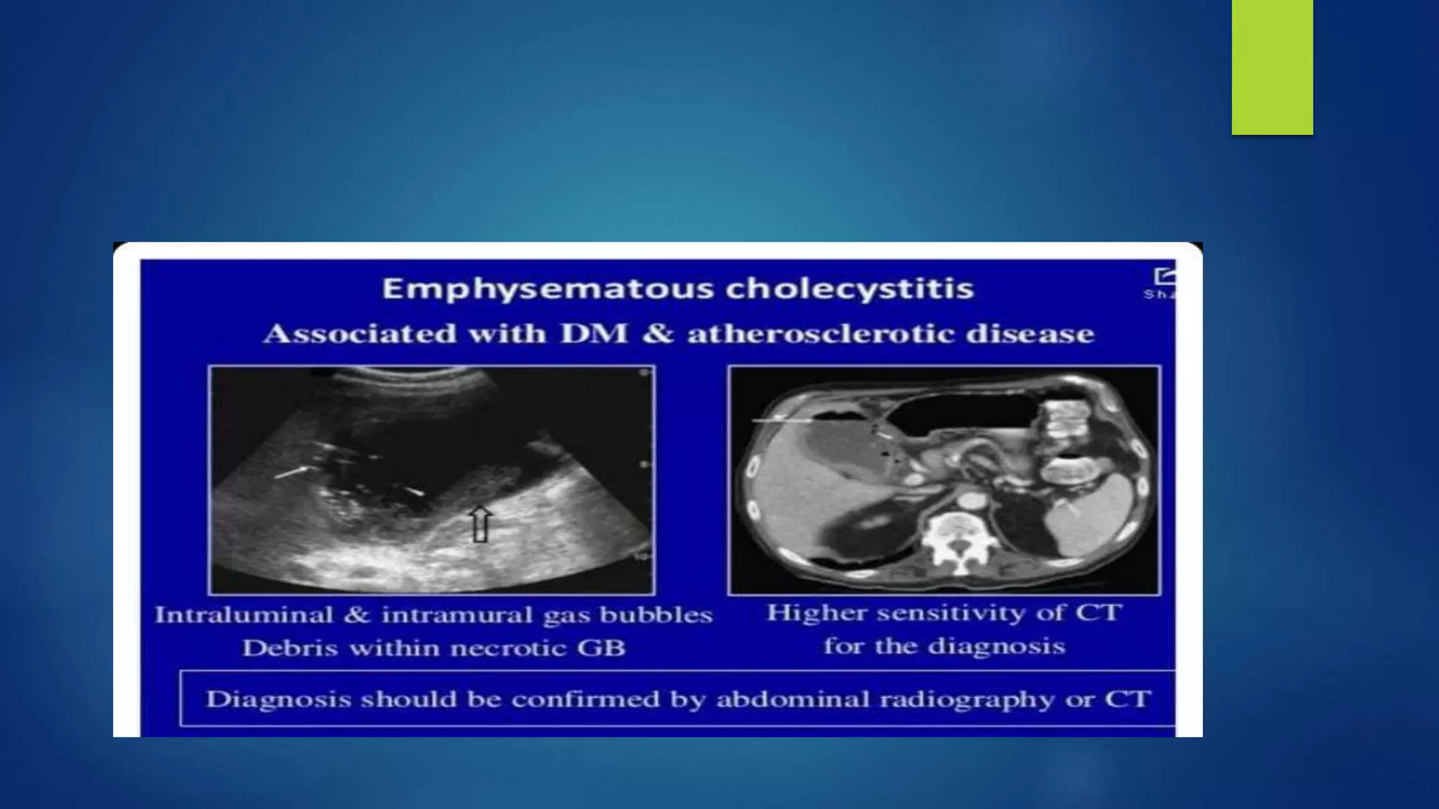 GALL BLADDER ^0 BILIARY PATHOLOGY.pptx