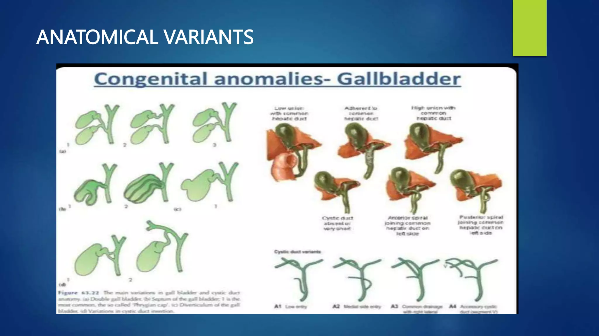 GALL BLADDER ^0 BILIARY PATHOLOGY.pptx