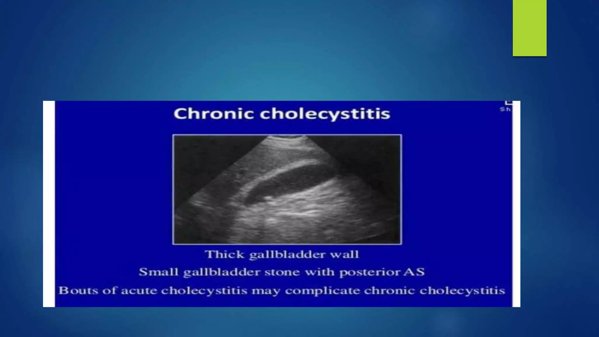 GALL BLADDER ^0 BILIARY PATHOLOGY.pptx