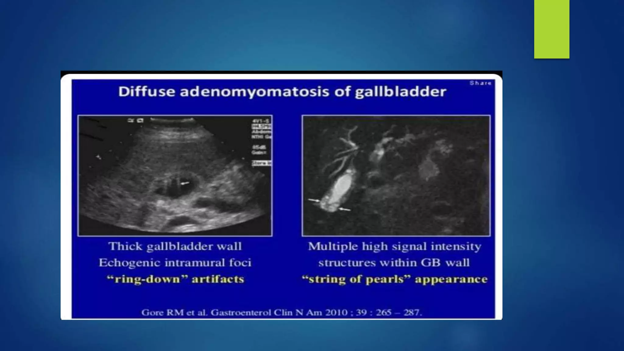 GALL BLADDER ^0 BILIARY PATHOLOGY.pptx