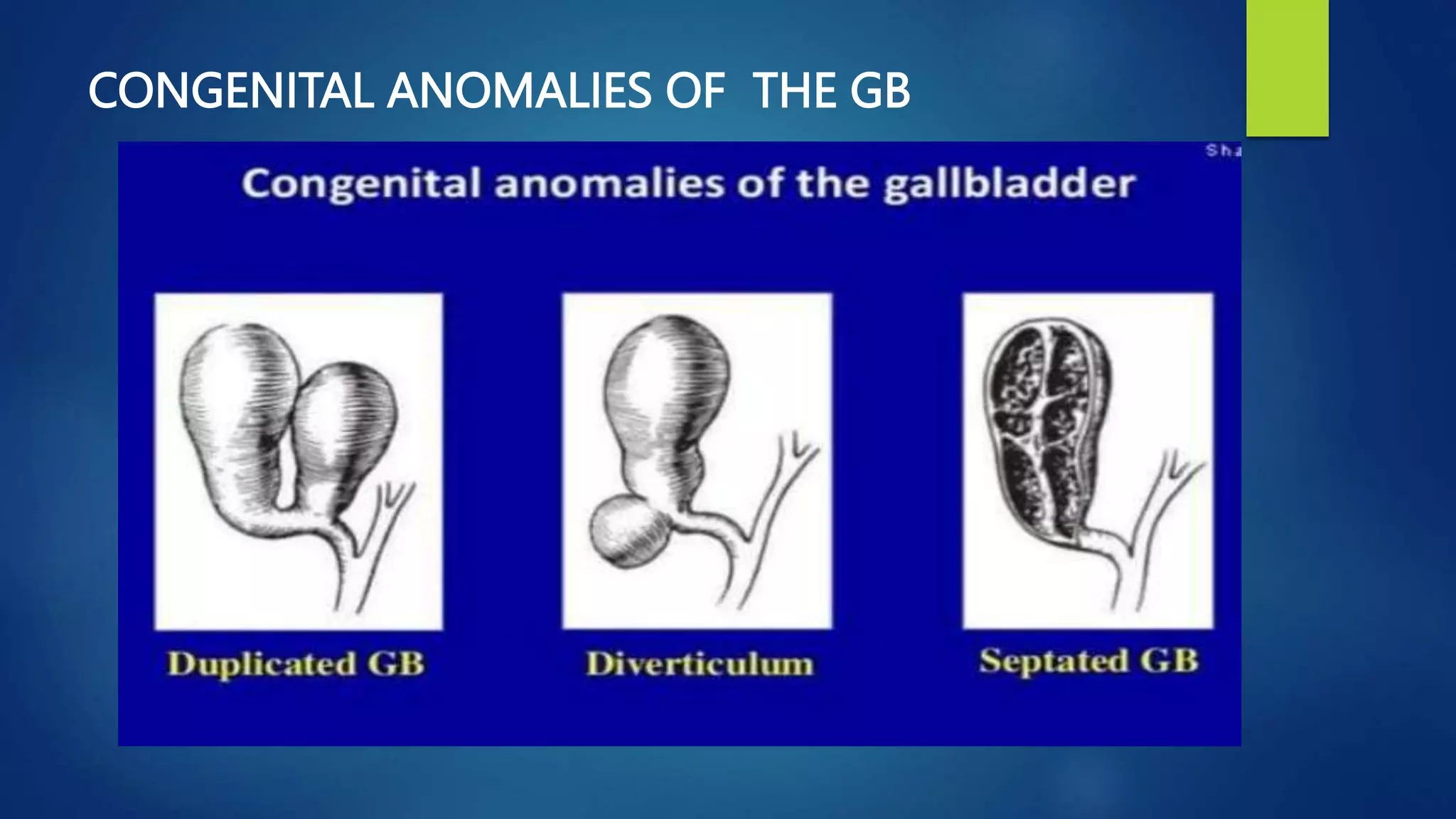 GALL BLADDER ^0 BILIARY PATHOLOGY.pptx