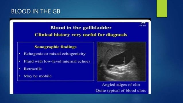 GALL BLADDER ^0 BILIARY PATHOLOGY.pptx