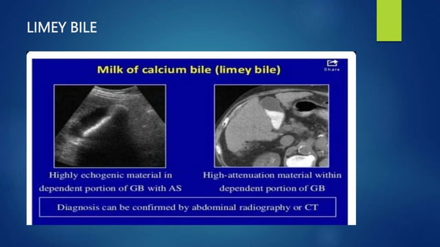 GALL BLADDER ^0 BILIARY PATHOLOGY.pptx