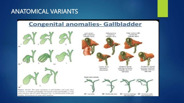 GALL BLADDER ^0 BILIARY PATHOLOGY.pptx