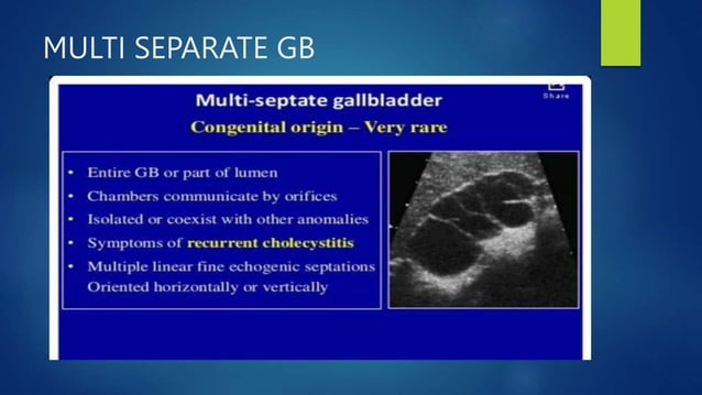 GALL BLADDER ^0 BILIARY PATHOLOGY.pptx