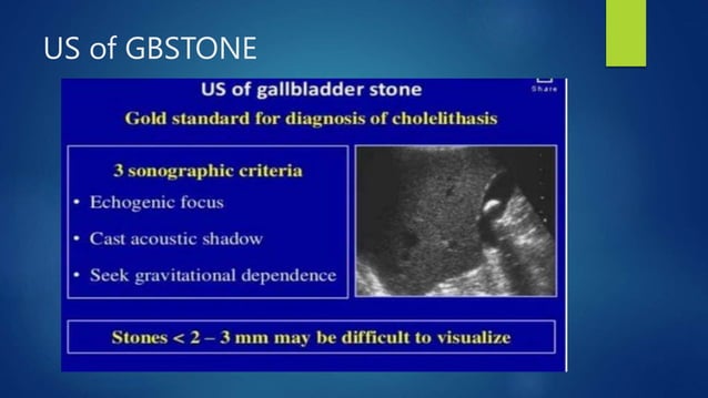 GALL BLADDER ^0 BILIARY PATHOLOGY.pptx