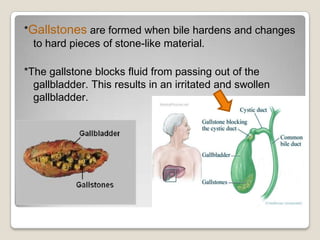 Gallbladder 11182011 | PPTX