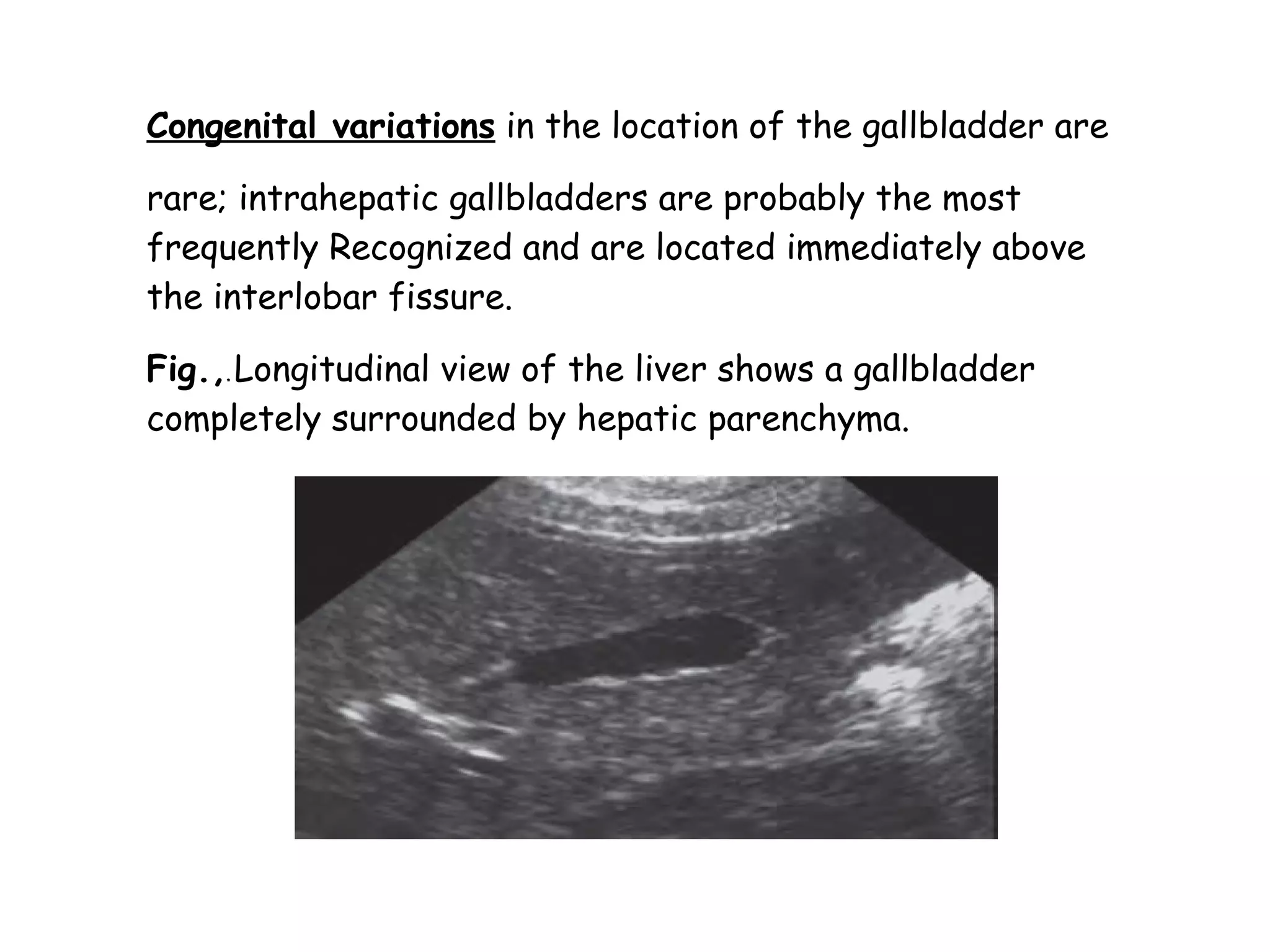Gall bladder Ultrasound | PPT