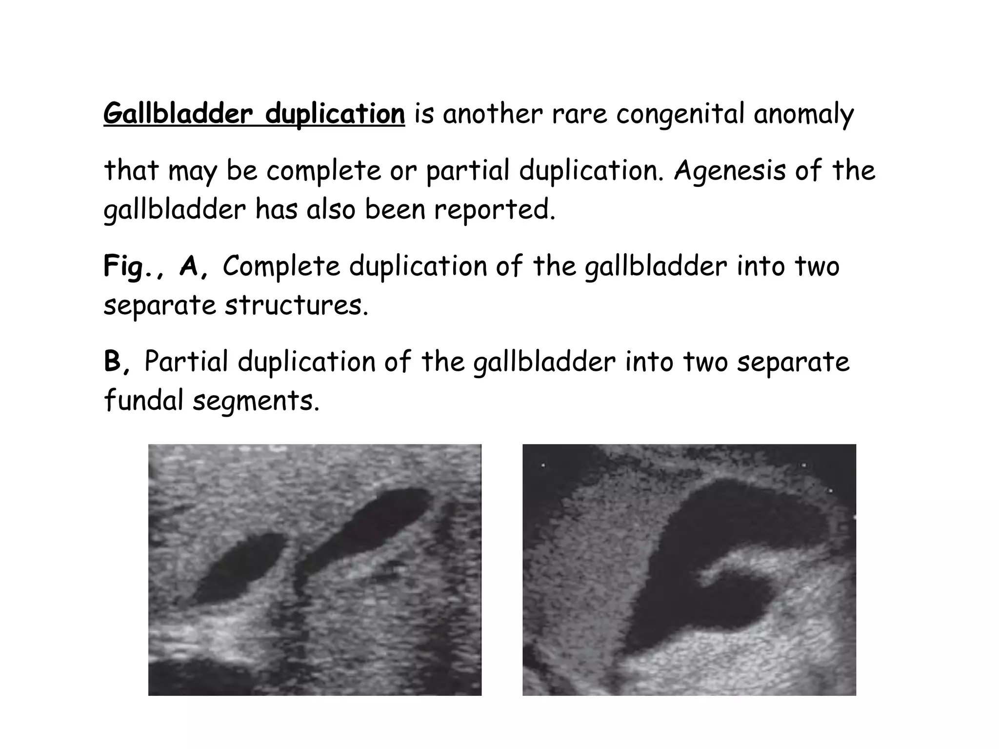 Gall bladder Ultrasound | PPT