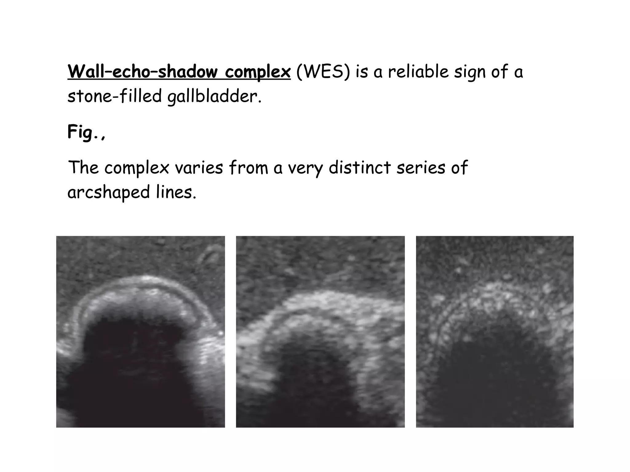 Gall bladder Ultrasound | PPT