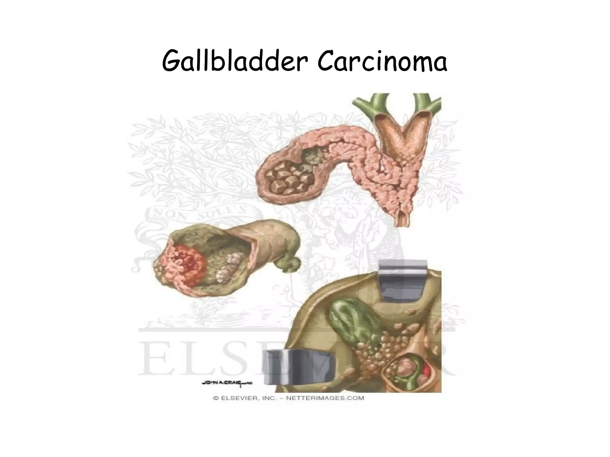 Gall bladder Ultrasound | PPT