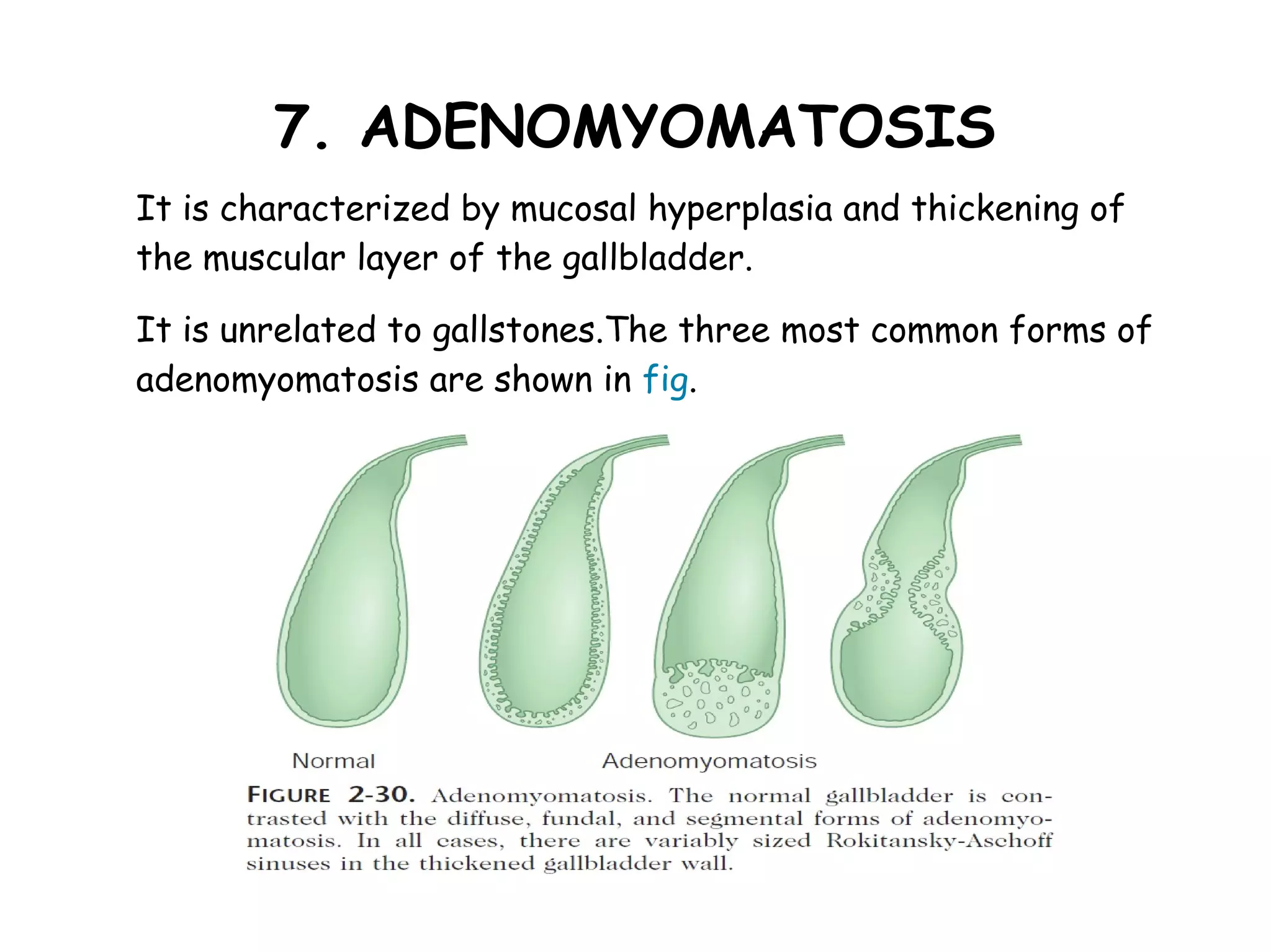 Gall bladder Ultrasound | PPT