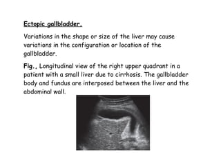 Gall bladder Ultrasound | PPT