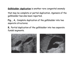Gall bladder Ultrasound | PPT