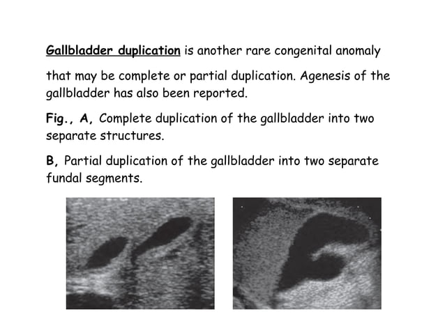 Gall bladder Ultrasound | PPT | Pregnancy | Reproductive Health