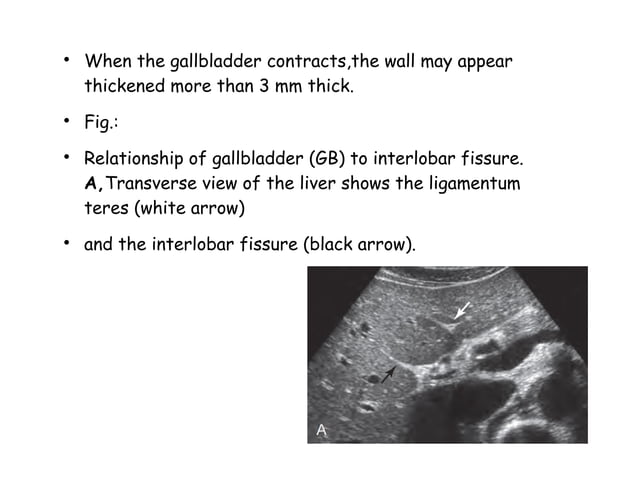 Gall bladder Ultrasound | PPT | Pregnancy | Reproductive Health
