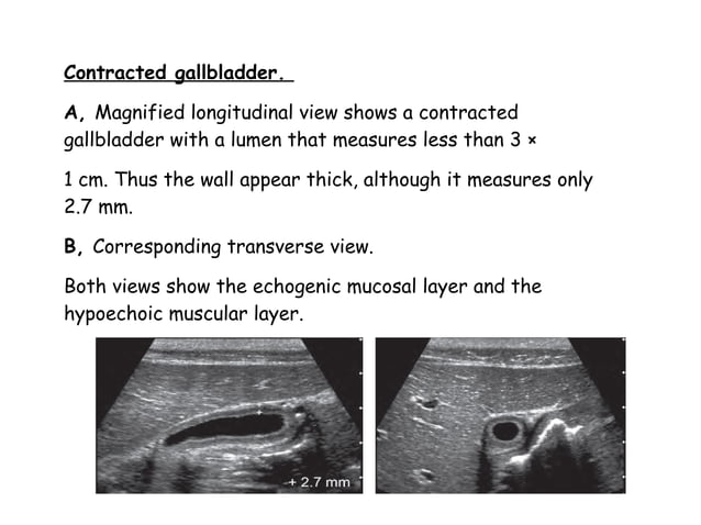 Gall bladder Ultrasound | PPT | Pregnancy | Reproductive Health