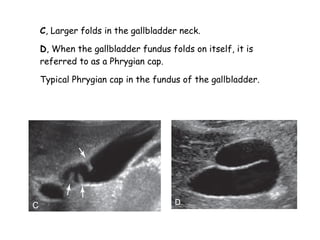 Gall bladder Ultrasound | PPT