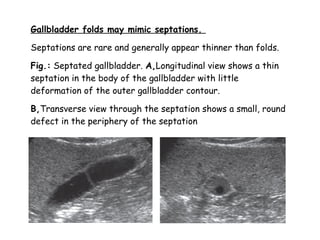 Gall bladder Ultrasound | PPT