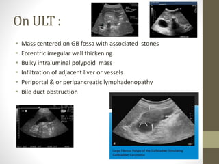 Anatomy and Sonography of Gallbladder | PPTX