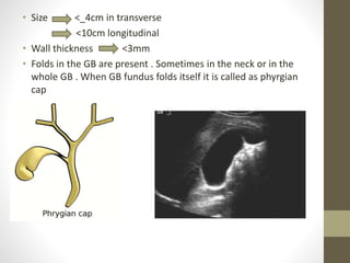 Anatomy and Sonography of Gallbladder | PPTX