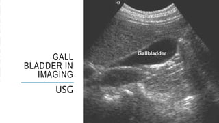 Gall bladder anatomy | PPTX
