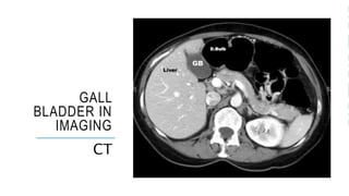 Gall bladder anatomy | PPTX