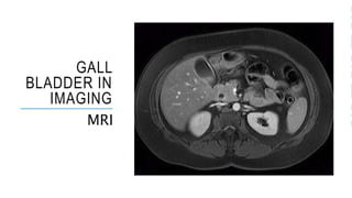 Gall bladder anatomy | PPTX