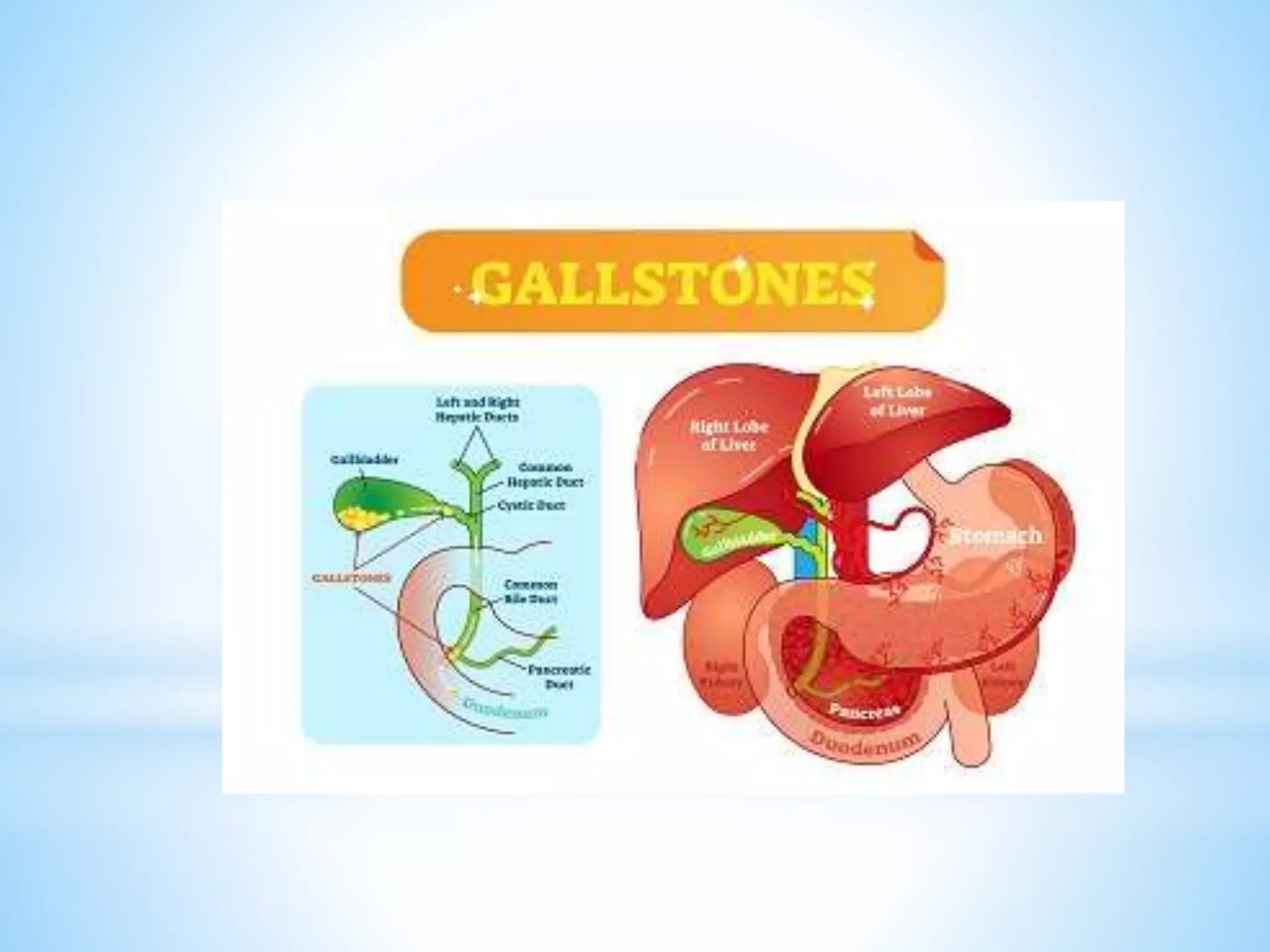 GALLBLADDER AND BILE (2).pptx