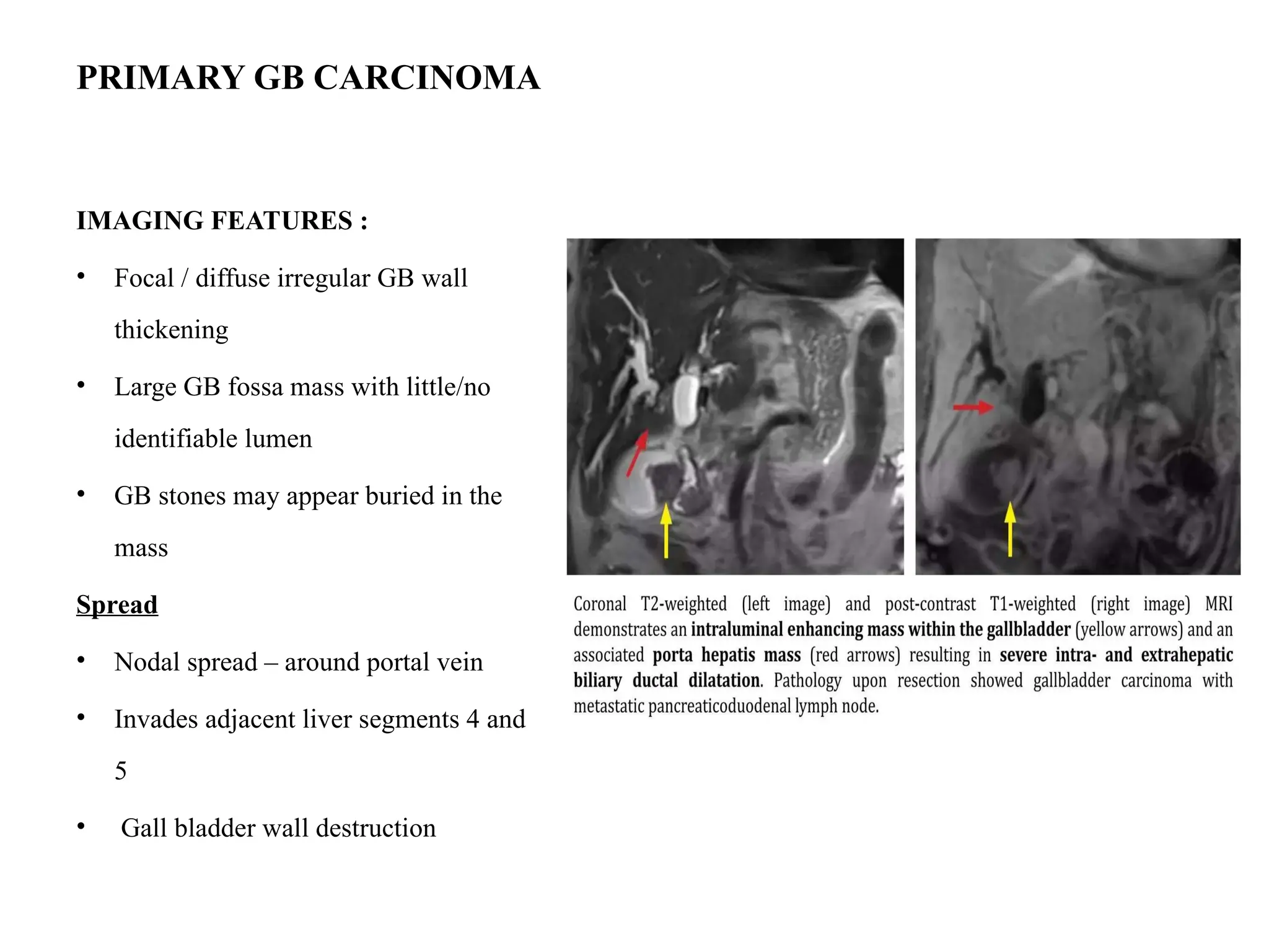 Gall bladder and biliary pathologies.pptx