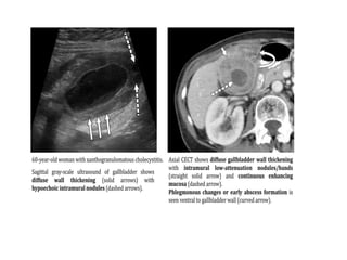 Gall bladder and biliary pathologies.pptx