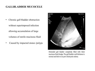 Gall bladder and biliary pathologies.pptx
