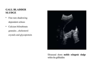 Gall bladder and biliary pathologies.pptx