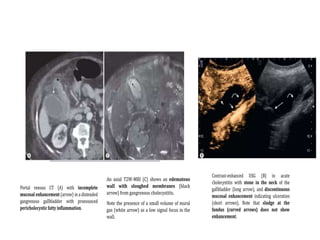 Gall bladder and biliary pathologies.pptx