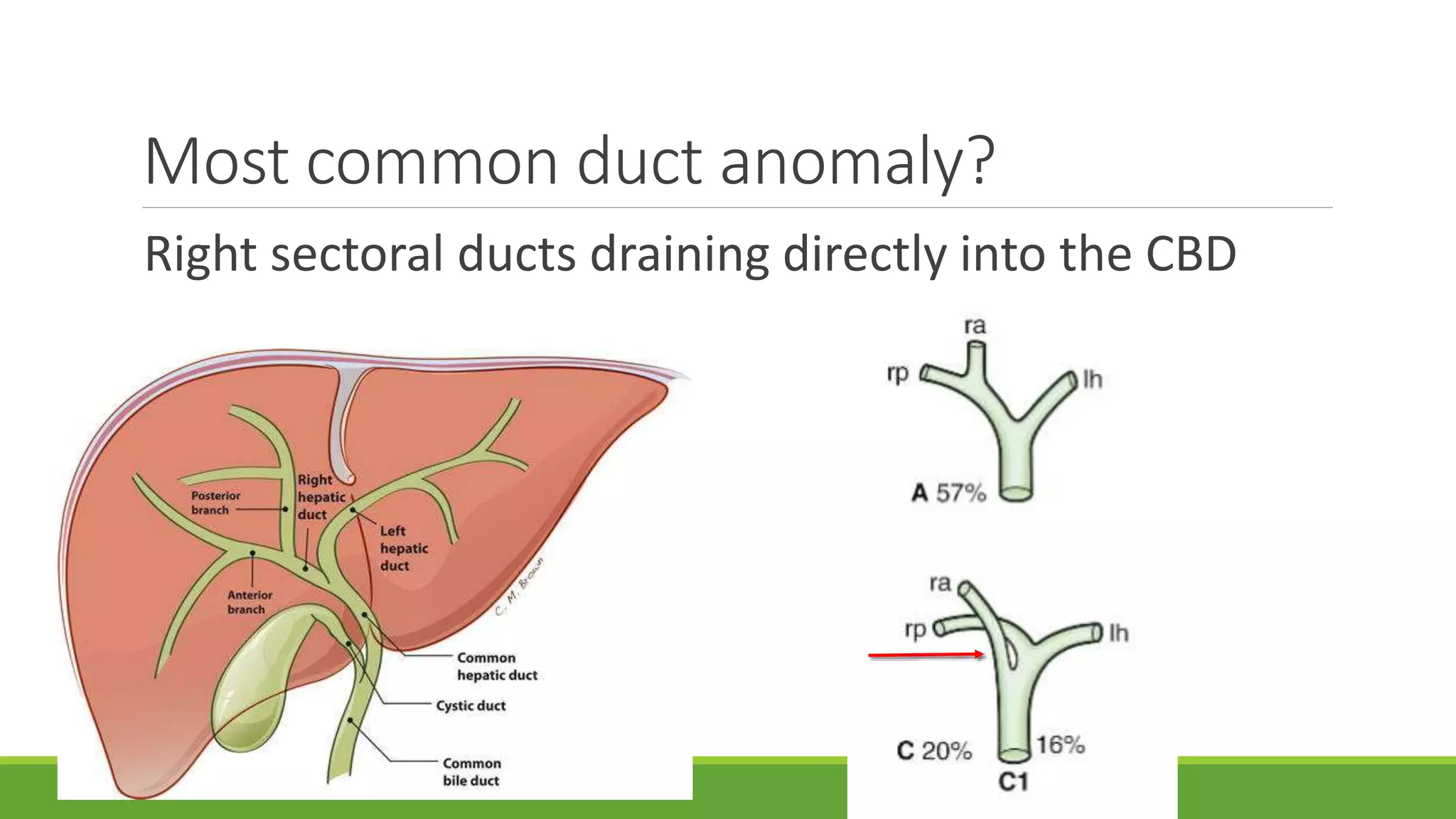 Gallbladder and biliary system 2019 absite | PPTX