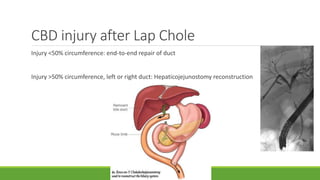 Gallbladder and biliary system 2019 absite | PPTX