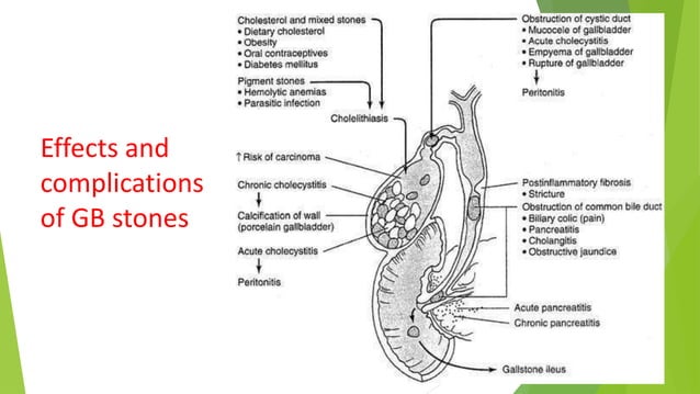 Gallbladder benign conditions | PPTX