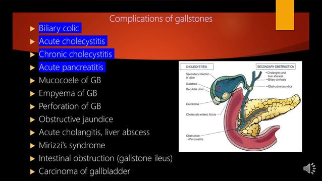 Gall bladder & bile ducts with narration | PPT