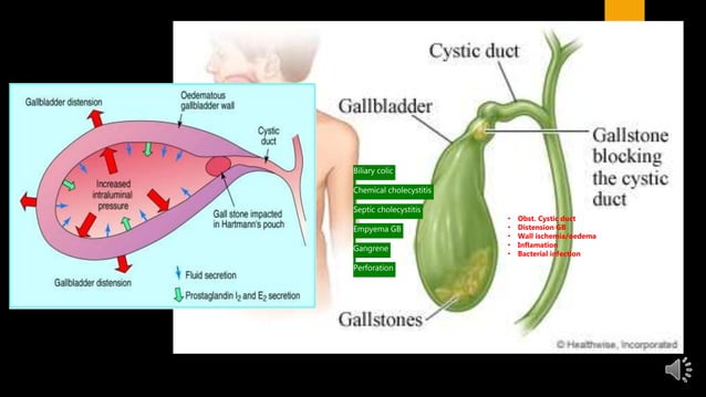 Gall bladder & bile ducts with narration | PPT