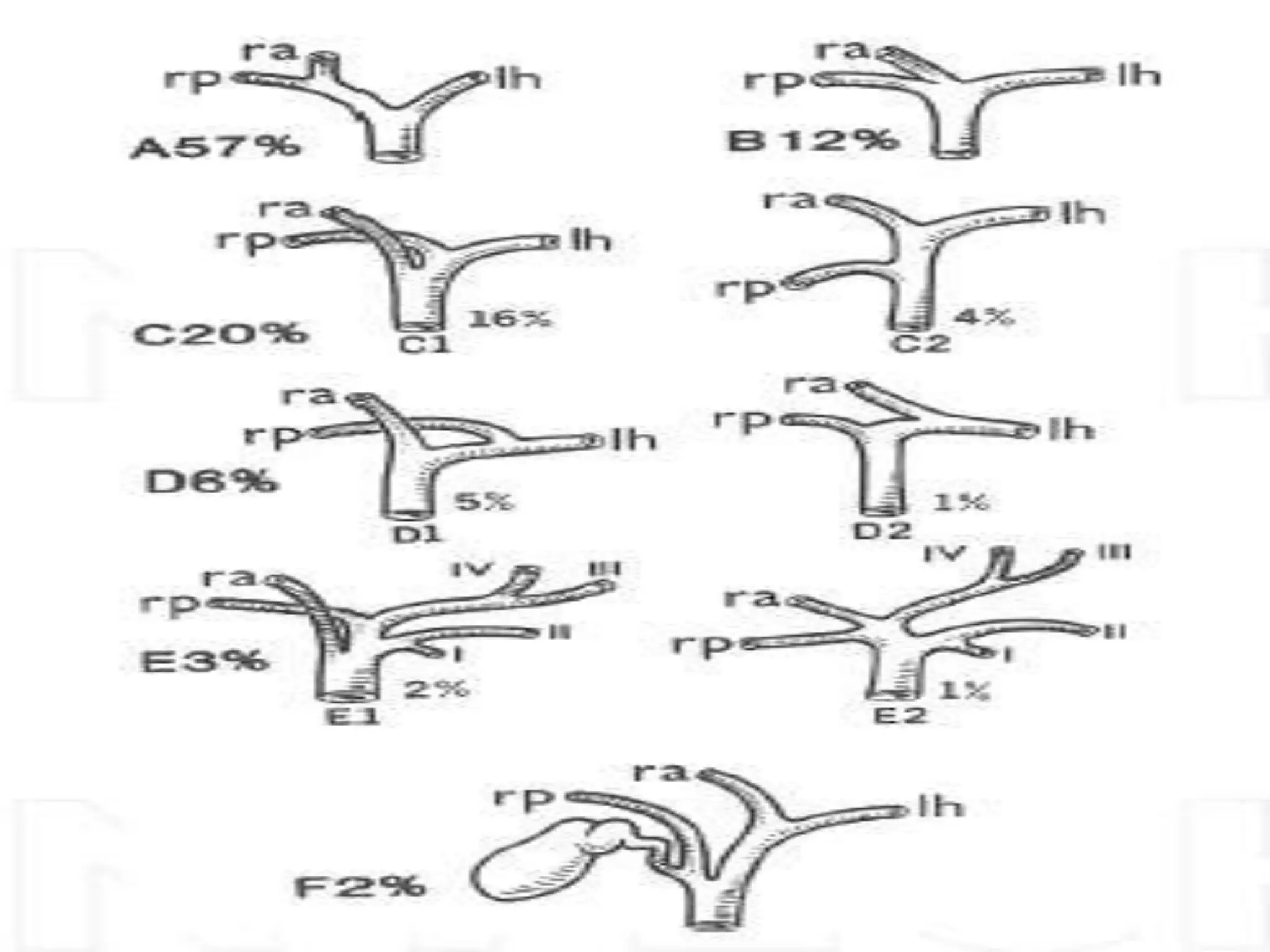 Gall bladder & biliary tract anomalies and variants | PPTX