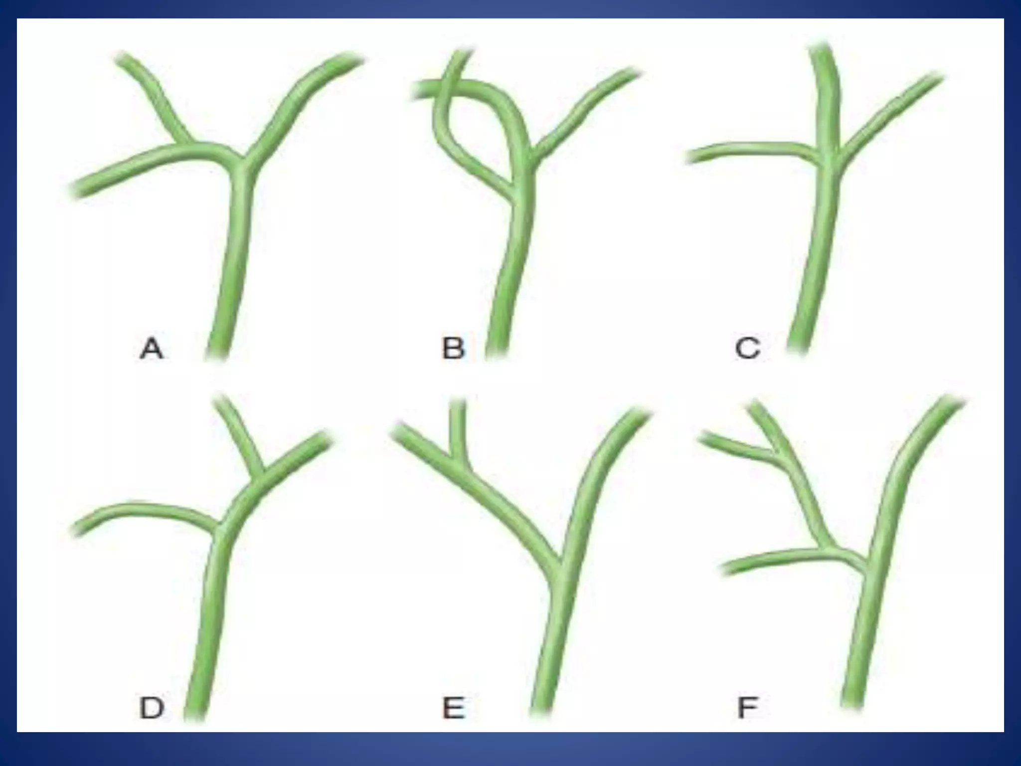 Gall bladder & biliary tract anomalies and variants | PPTX