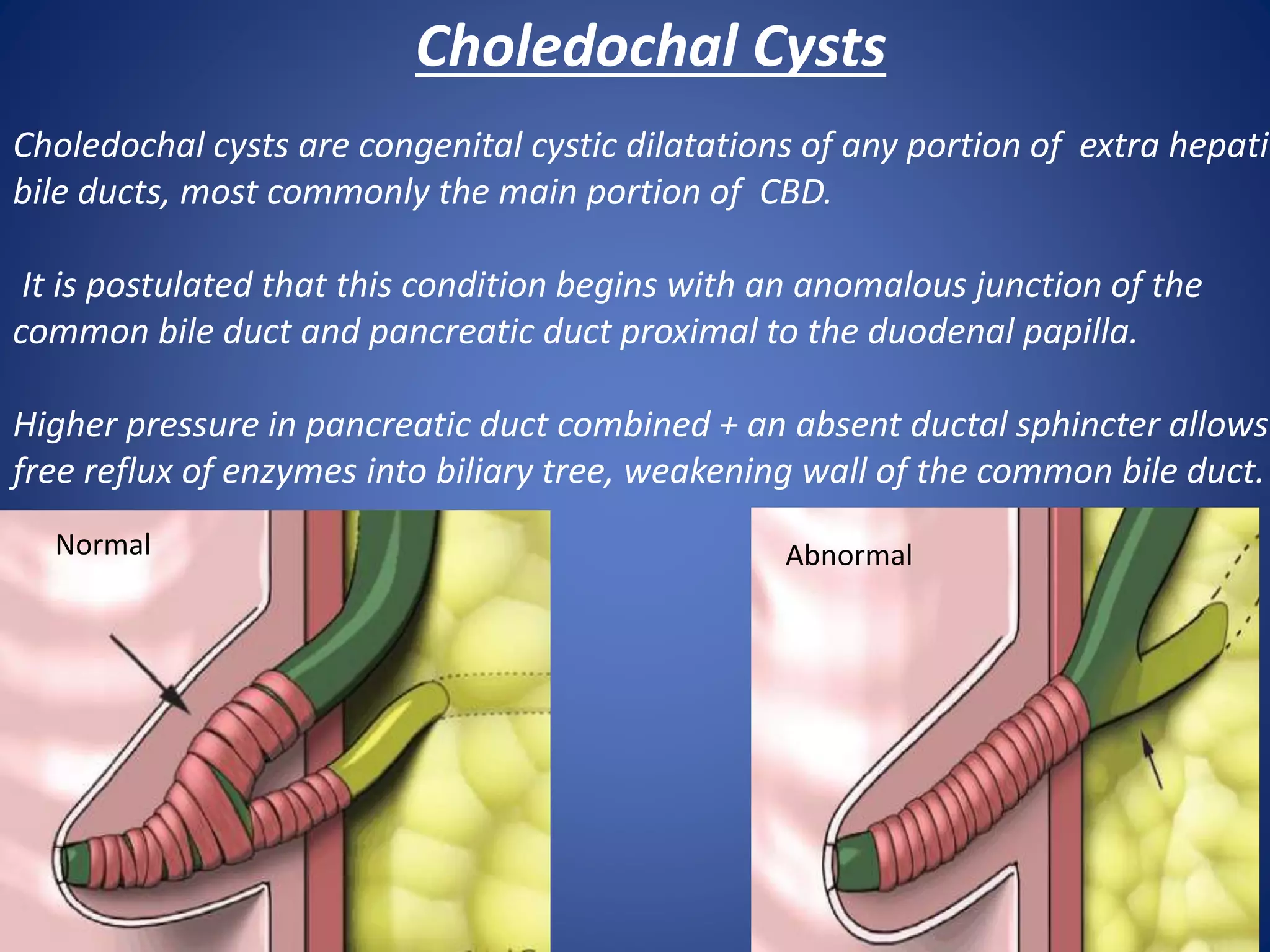 Gall bladder & biliary tract anomalies and variants | PPTX