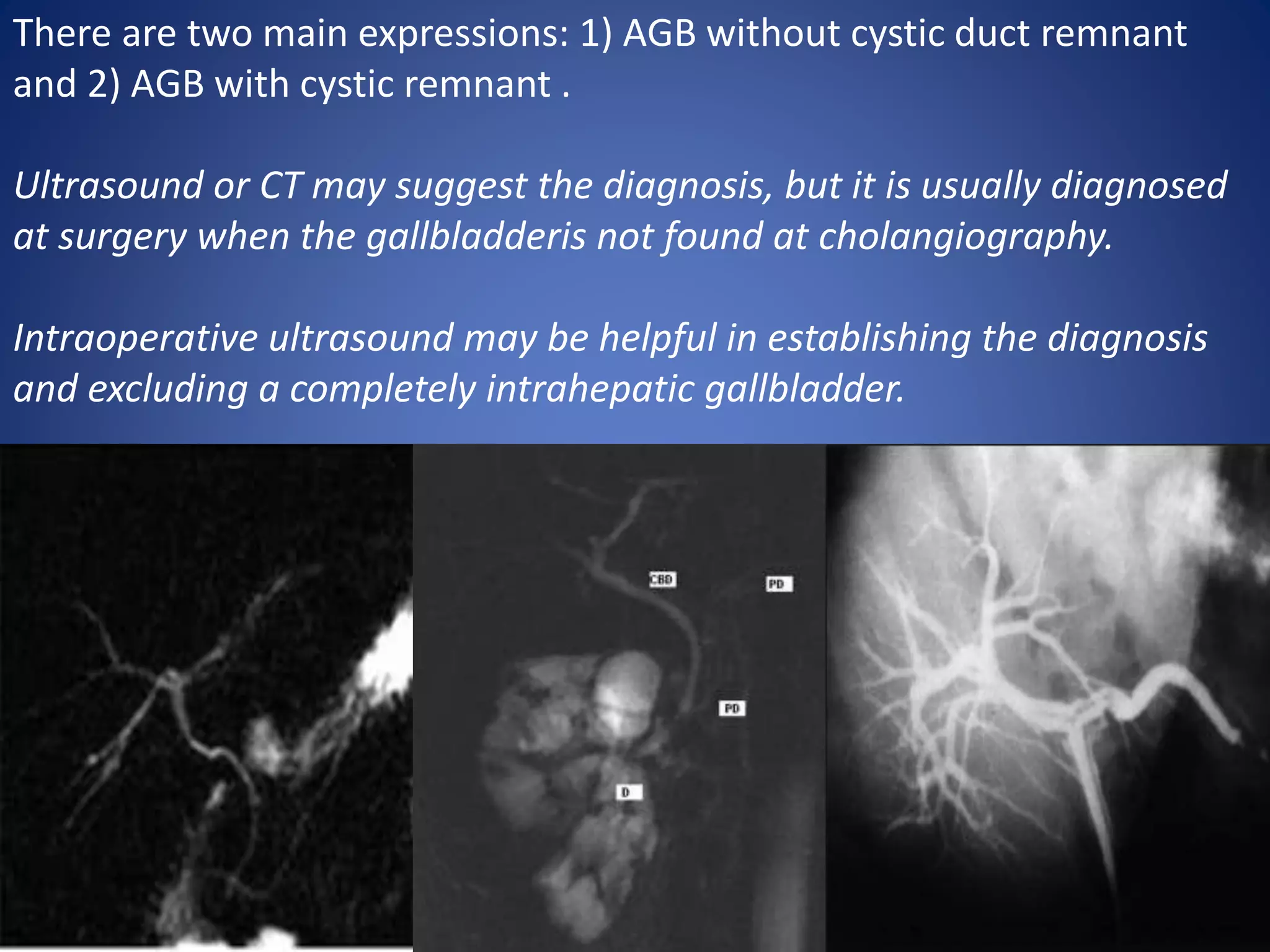 Gall bladder & biliary tract anomalies and variants | PPTX