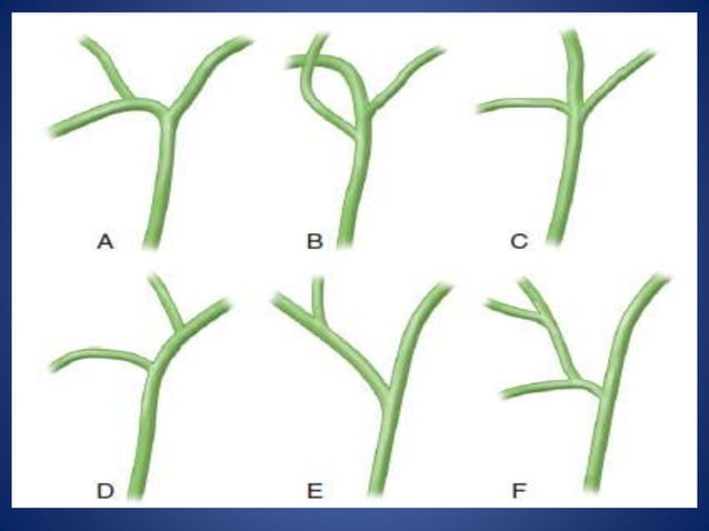 Gall bladder & biliary tract anomalies and variants | PPTX | Pregnancy ...