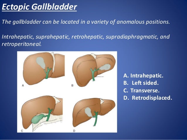Gall bladder & biliary tract anomalies and variants