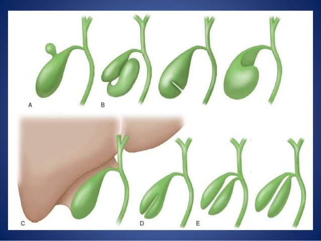 Gall bladder & biliary tract anomalies and variants